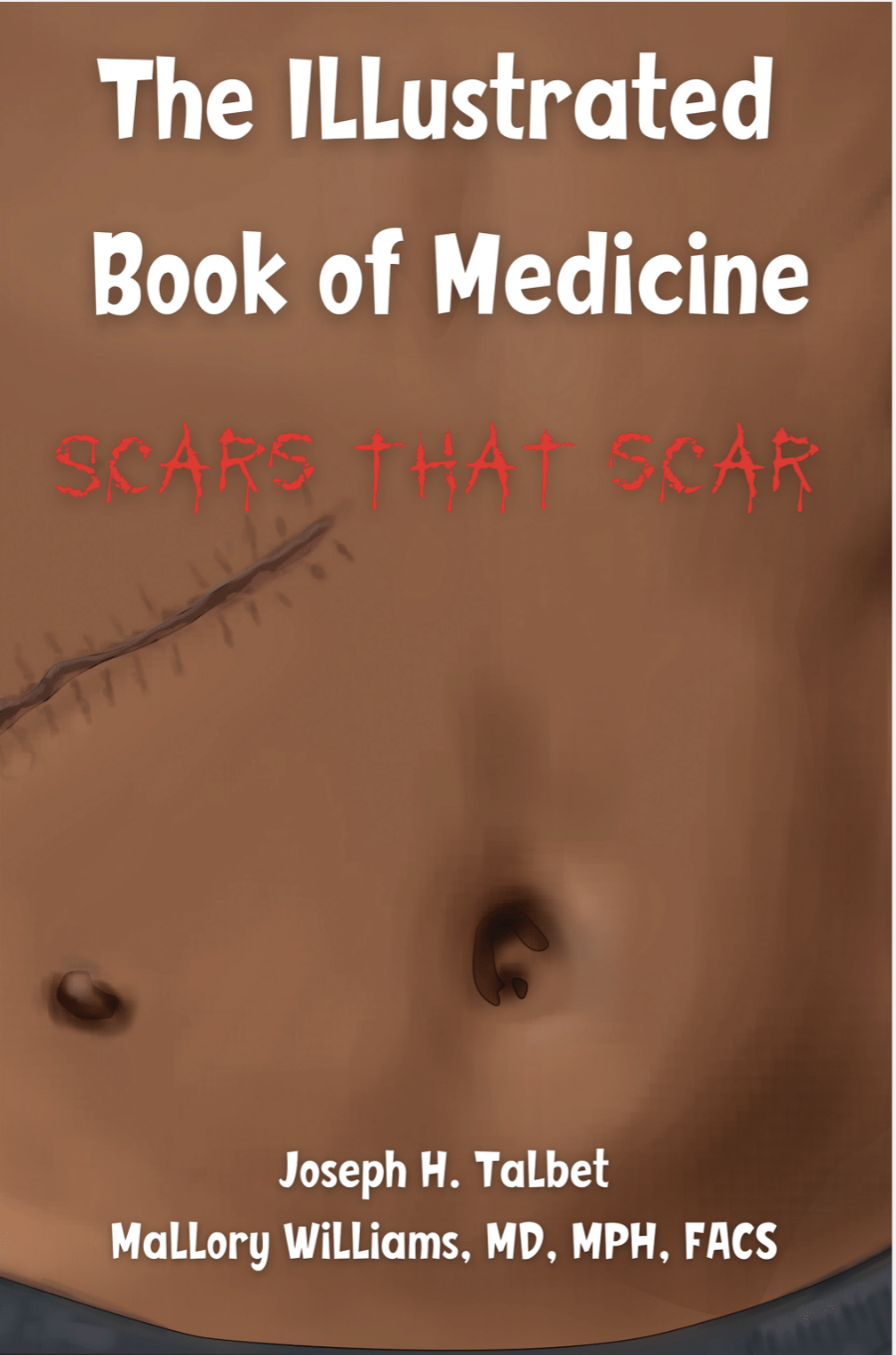 The Illustrated Book of Medicine: Scars that Scar | Columbia Alumni ...
